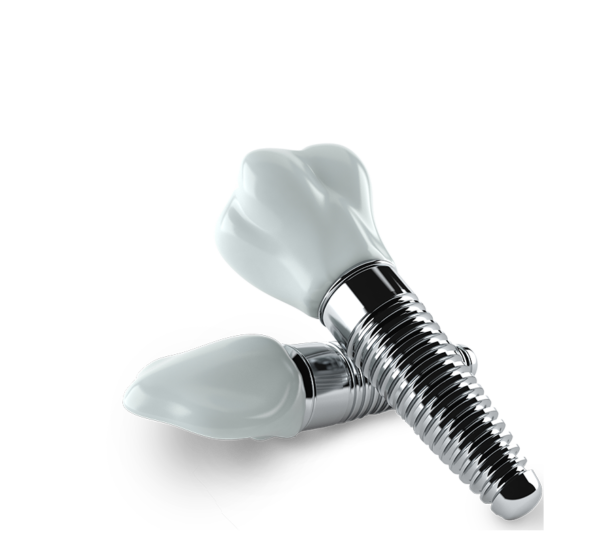 Benefits of Titanium Dental Implants - Bosetitanium